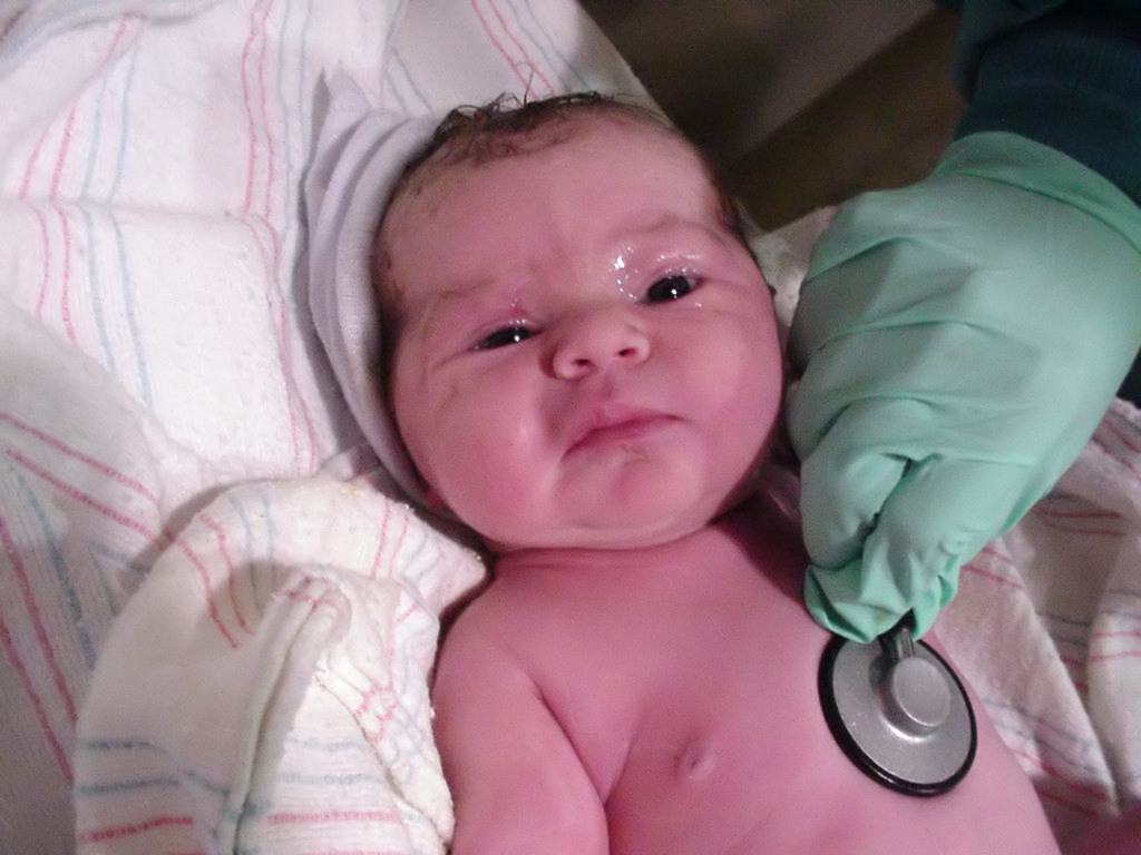 birth defects Archives - New Jersey Medical Malpractice Lawyers - NJ ...
